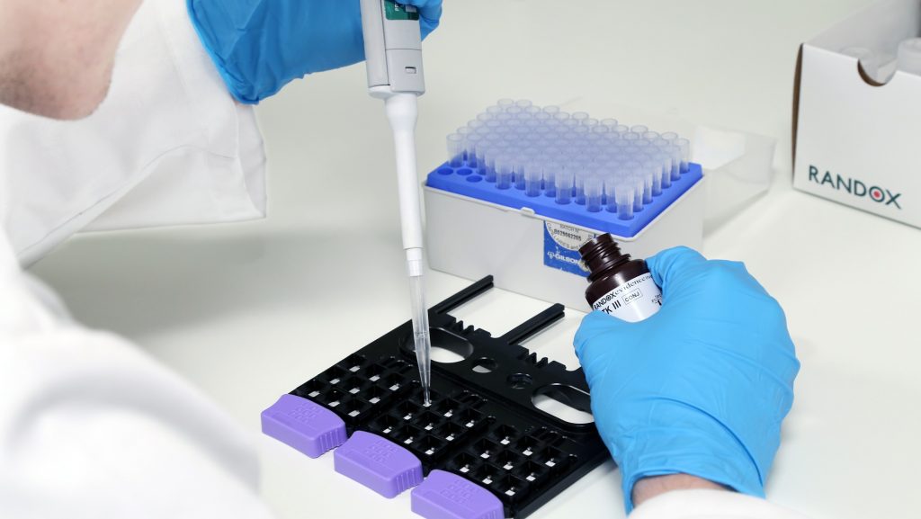 New UK-developed test can help predict who will develop type 1 diabetes ...